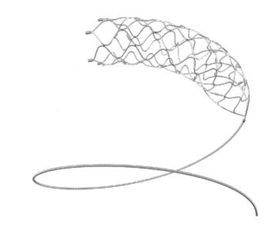 Solitaire X Revascularization Device For Acute Ischemic Stroke