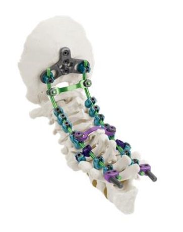 Quartex - Spine - Posterior Cervical - Fixation - Stabilization System ...