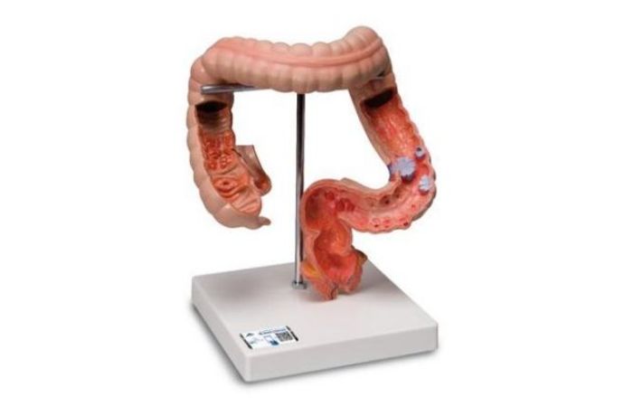 3B Scientific - Anatomical Models - Digestive System Models - Smart ...