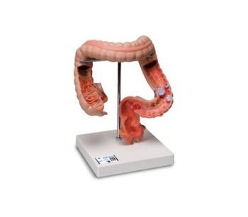 3B Scientific - Anatomical Models - Digestive System Models - Smart ...