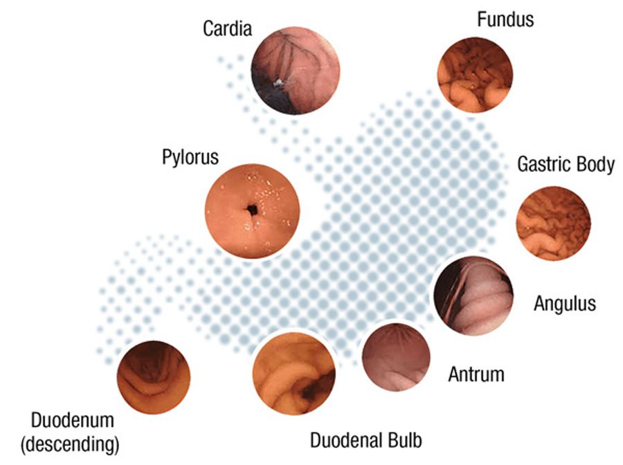 NAVICAM Stomach Capsule Endoscopy System