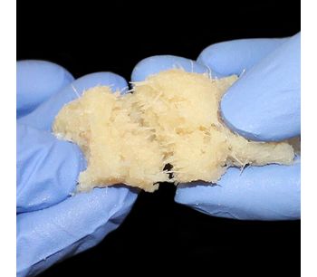 Aziyo - Orthopedic & Spine - Fiber Viable Bone Matrix By ...