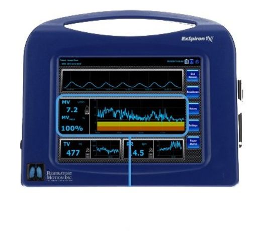 Exspiron 1Xi - Minute - Respiratory Ventilation Monitor By ...