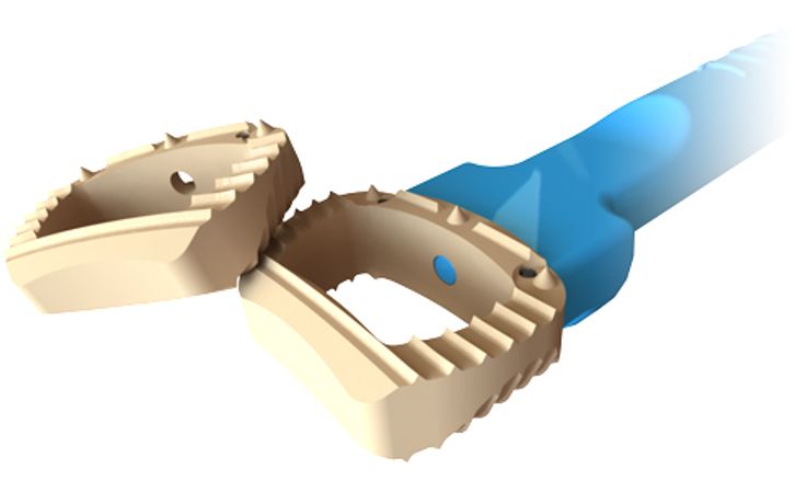 Medicrea IMPIX-MANTA - CERVICAL Range - Cervical Interbody Device By ...