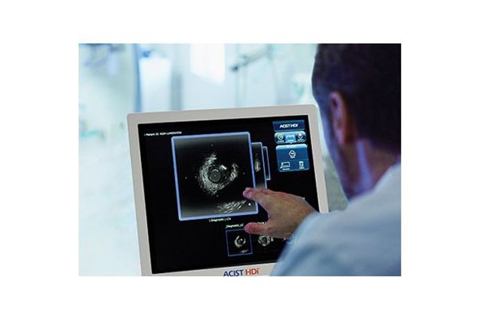 ACIST - Hdi - Others - High-Definition IVUS System By ACIST ...