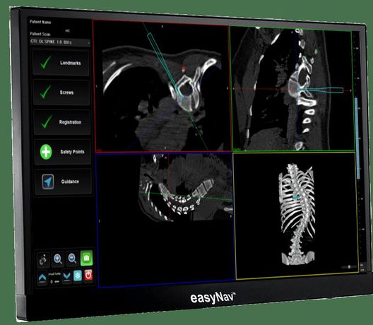Easynav - Spine Navigation System By HRS Navigation