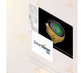 Nexstim - Transcranial Magnetic Stimulation Technology (TMS)