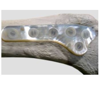 Mega-Biopharma - Orthopaedics - Trauma Plates By Mega Biopharma