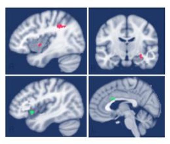 Parasym - Non-Invasive Neuromodulation Device For Mood Enhancement ...