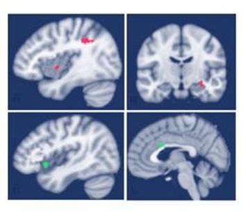 Parasym - Non-Invasive Neuromodulation Device For Mood Enhancement ...