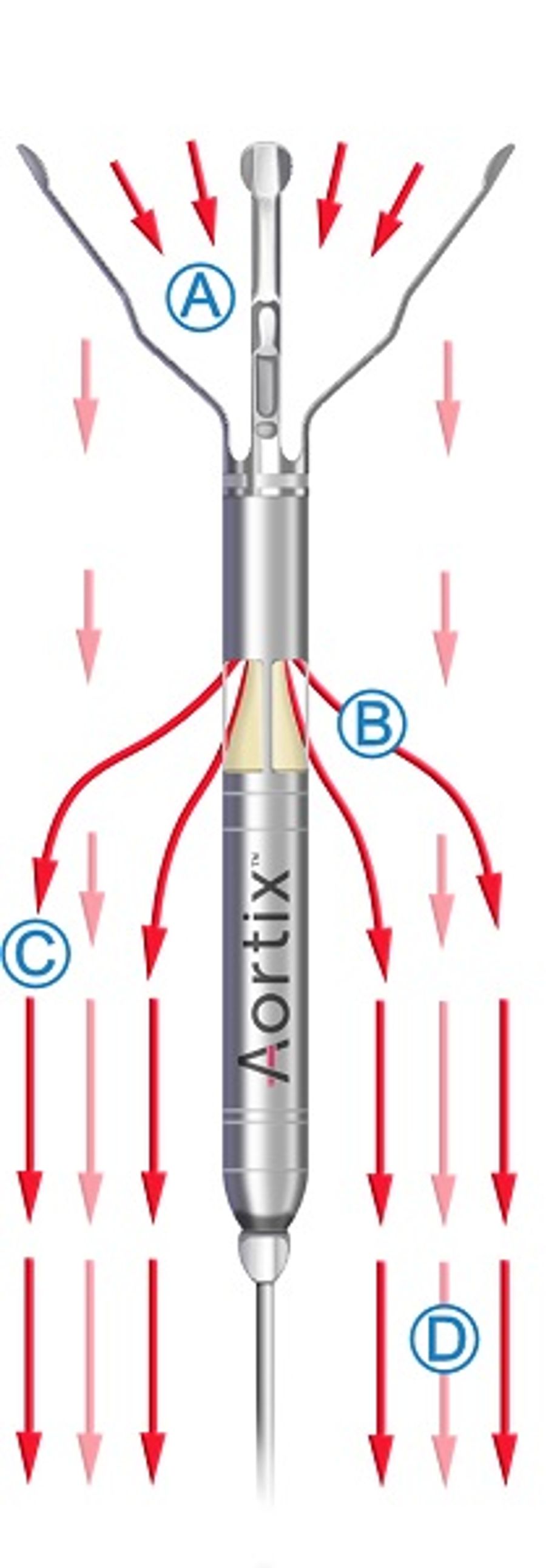 Procyrion Aortix - Percutaneous Mechanical Circulatory Support (Pmcs ...