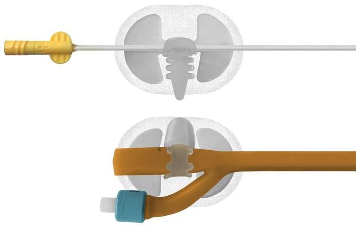 AMT - CINCH - Enteral - Tube Securement Device By Applied ...