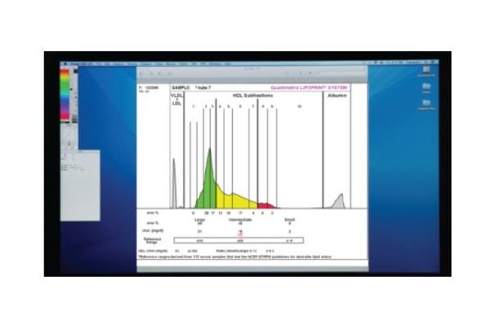 Lipoprint HDL Lipoprotein Subfractions Testing System