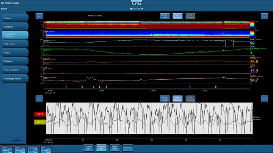 Moberg CNS EEG Monitor