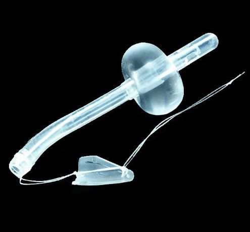 Spanner - Prostatic Stent By SRS Medical