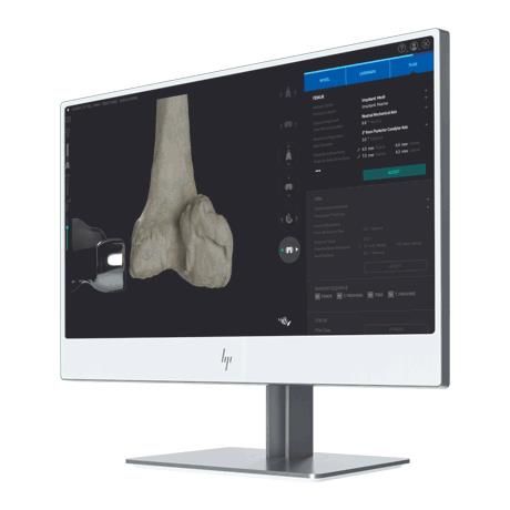Think-Surgical TPLAN 3D Planning Workstation Software
