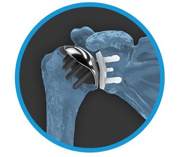 Archer - CSR - Total Shoulder System By Catalyst Orthoscience Inc.