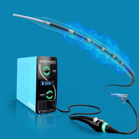 Shockwave - M5+ - Intravascular Lithotripsy (IVL) Device By ...