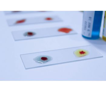 In Vitro Diagnostic Reagents & Assays - Blood Grouping ...
