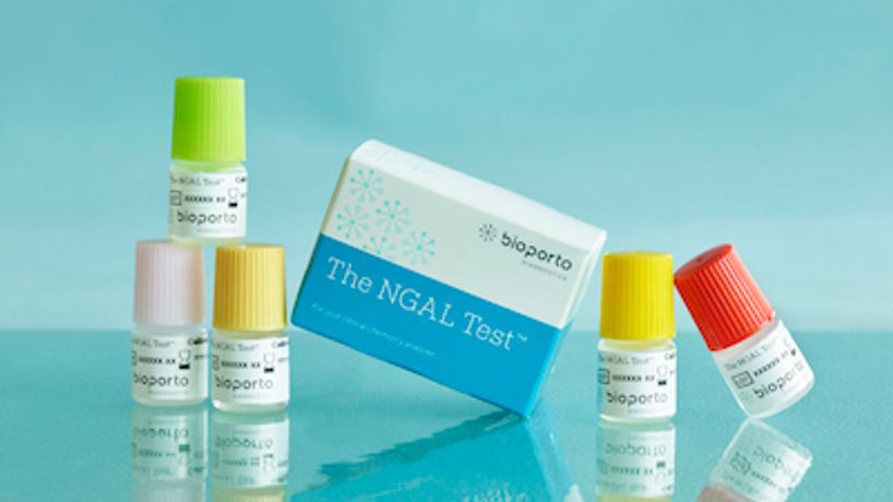 Bioporto - ST002 - NGAL Biomarker - NGAL Test Calibrator Kit ...