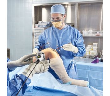 Intellijoint KNEE - Surgeon-Controlled Navigation System By ...