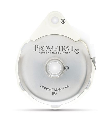Prometra - Healthcare Products - Programmable Pump By Flowonix Medical Inc.