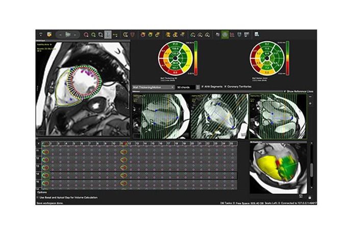Cvi42 - Cardiovascular MRI By Circle Cardiovascular Imaging Inc.