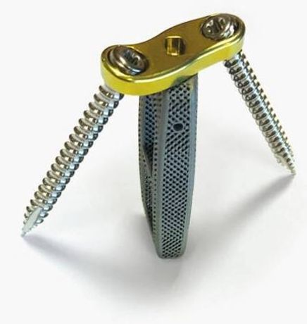 Idys LLIF 3Dti Lateral Lumbar Interbody System