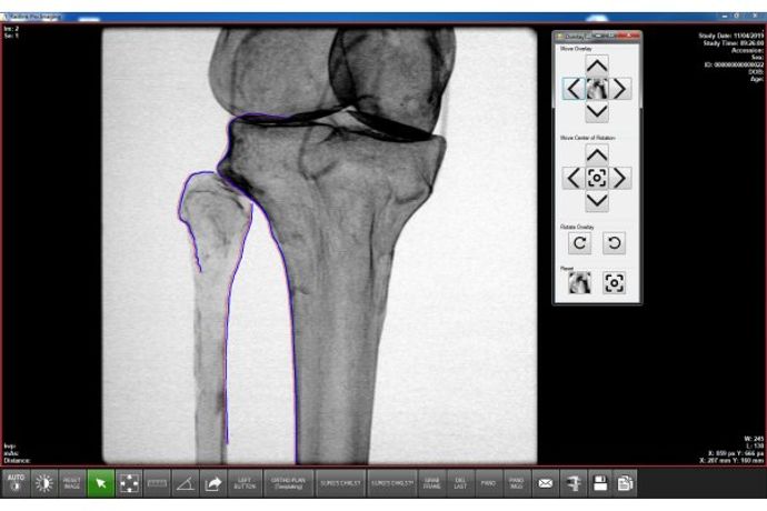 Surgeon Checklist Trauma Confirm Proper Alignment, Positioning ...