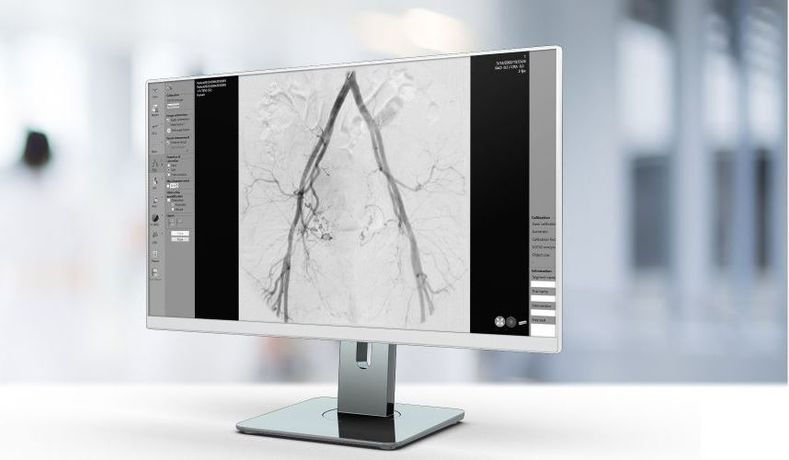 Caas - QVA - Percutaneous Intervention - Caas Workstation