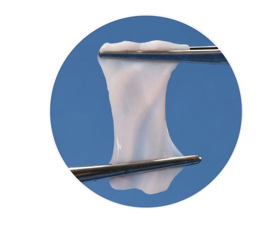 GEO Matrix & Umbilicord - Biologics And Tissue By Gramercy Extremity ...