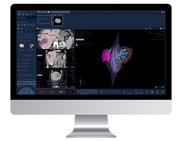 Myrian XP-Liver Clinical Apps Myrian XP-Liver Clinical Apps