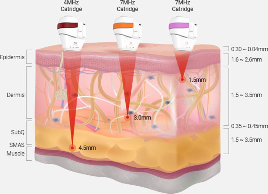 Tightan Pro Upgraded HIFU Device For Skin Lifting & Tightening