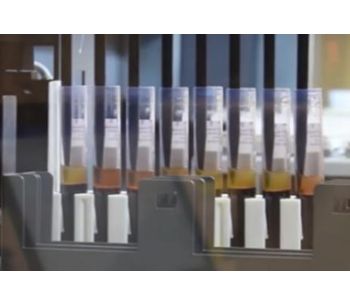 Tubeeye - Blood Fractionation And Buffy Coat / Pbmc Extraction By ...