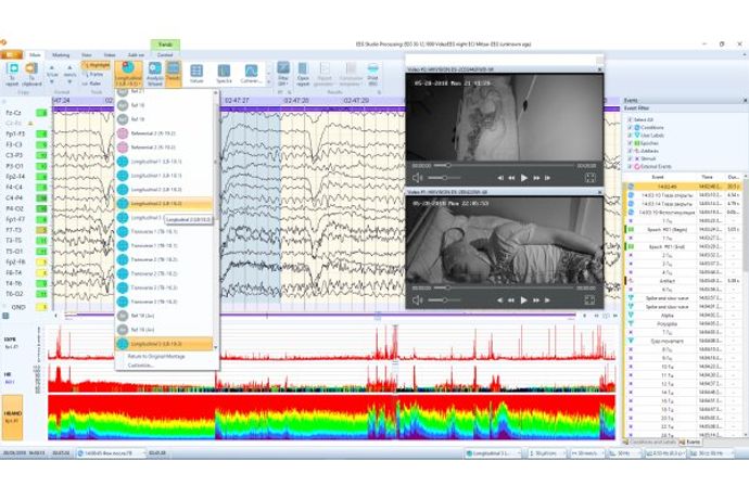 Eegstudio LTM Software