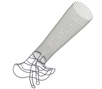 Laminate Vasq Arteriovenous Fistula (AVF) Failure Procedure