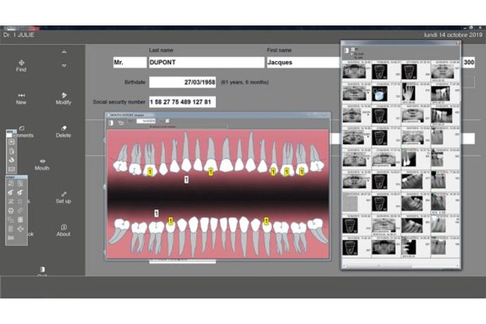 Owandy Radiology - Quickvision - Comprehensive Dental Imagery Software Solution By Owandy ...