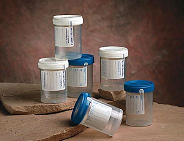 ESS Sterile Bacti Bottles