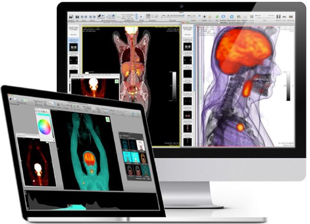 Osirix MD Medical Imaging Viewer Software